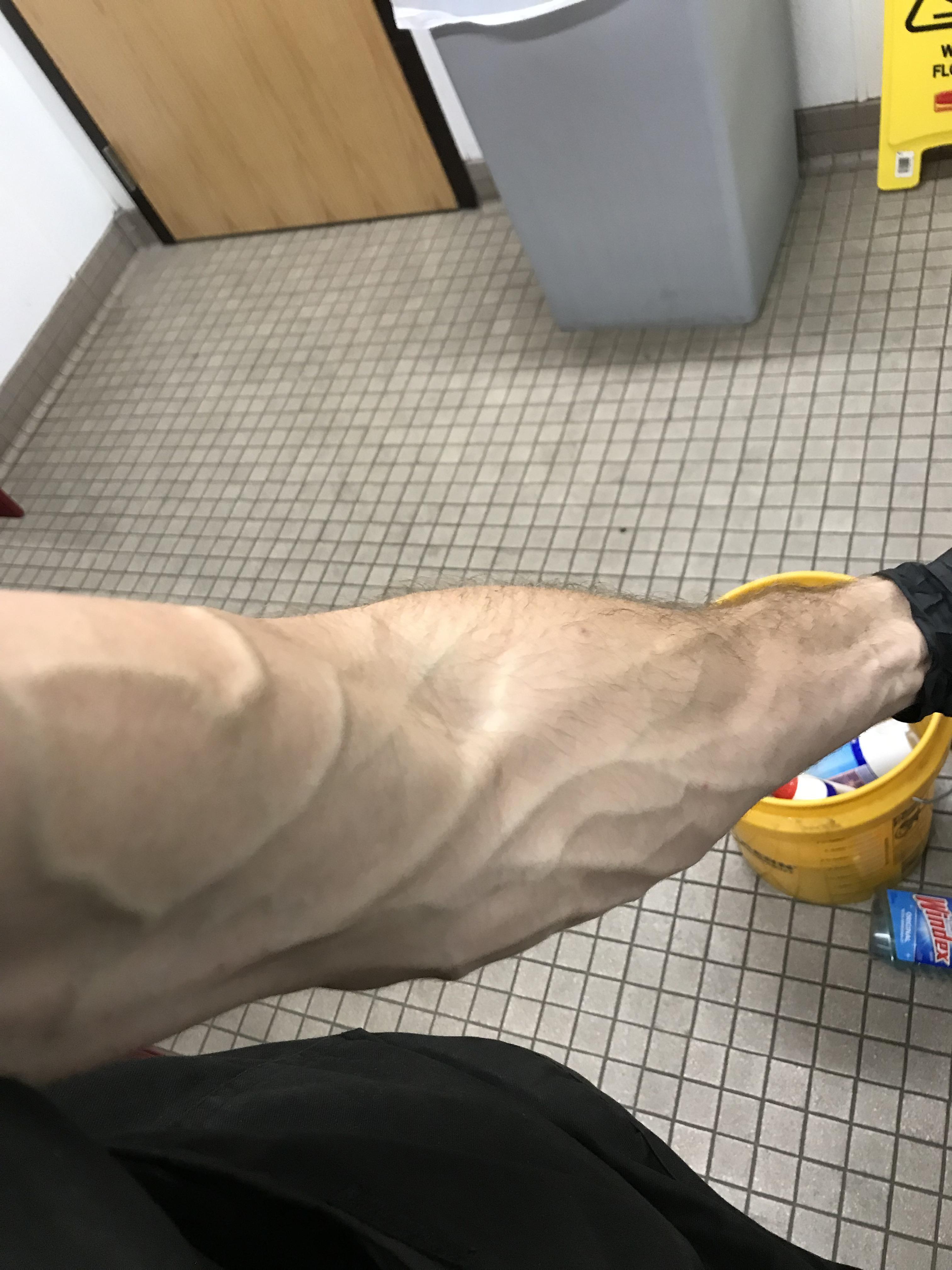 Fan of veins? | Scrolller