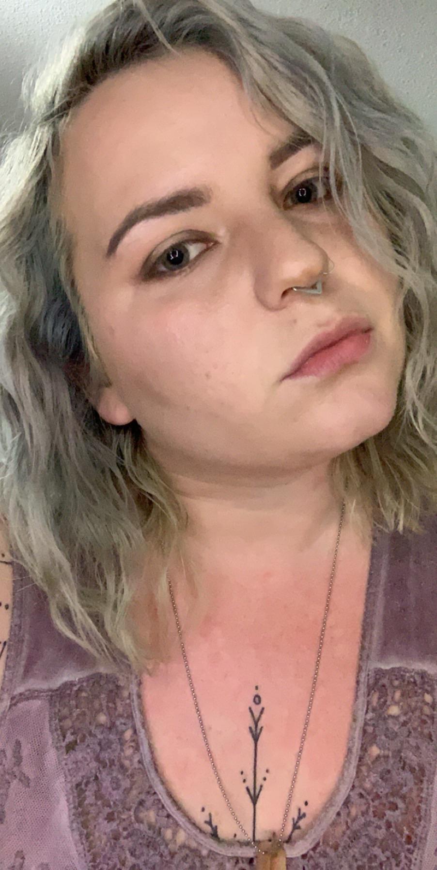 Finally healed. | Scrolller