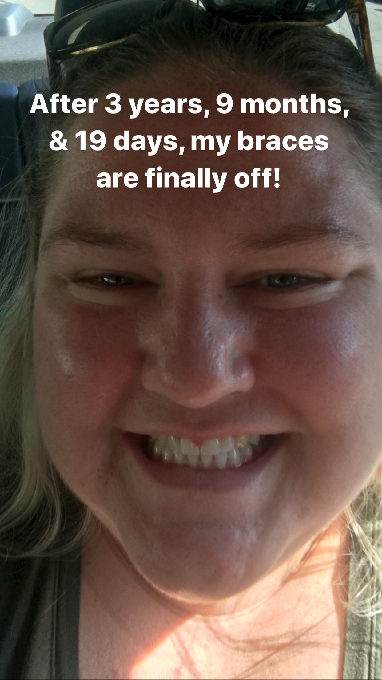 Finally Off! | Scrolller