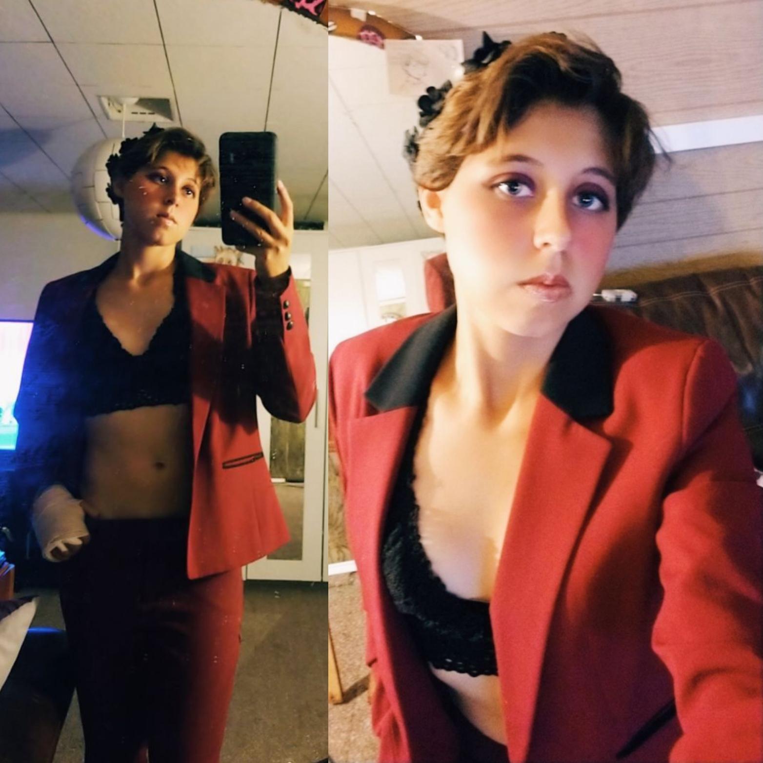 First time I've felt attractive since my cast was put on | Scrolller