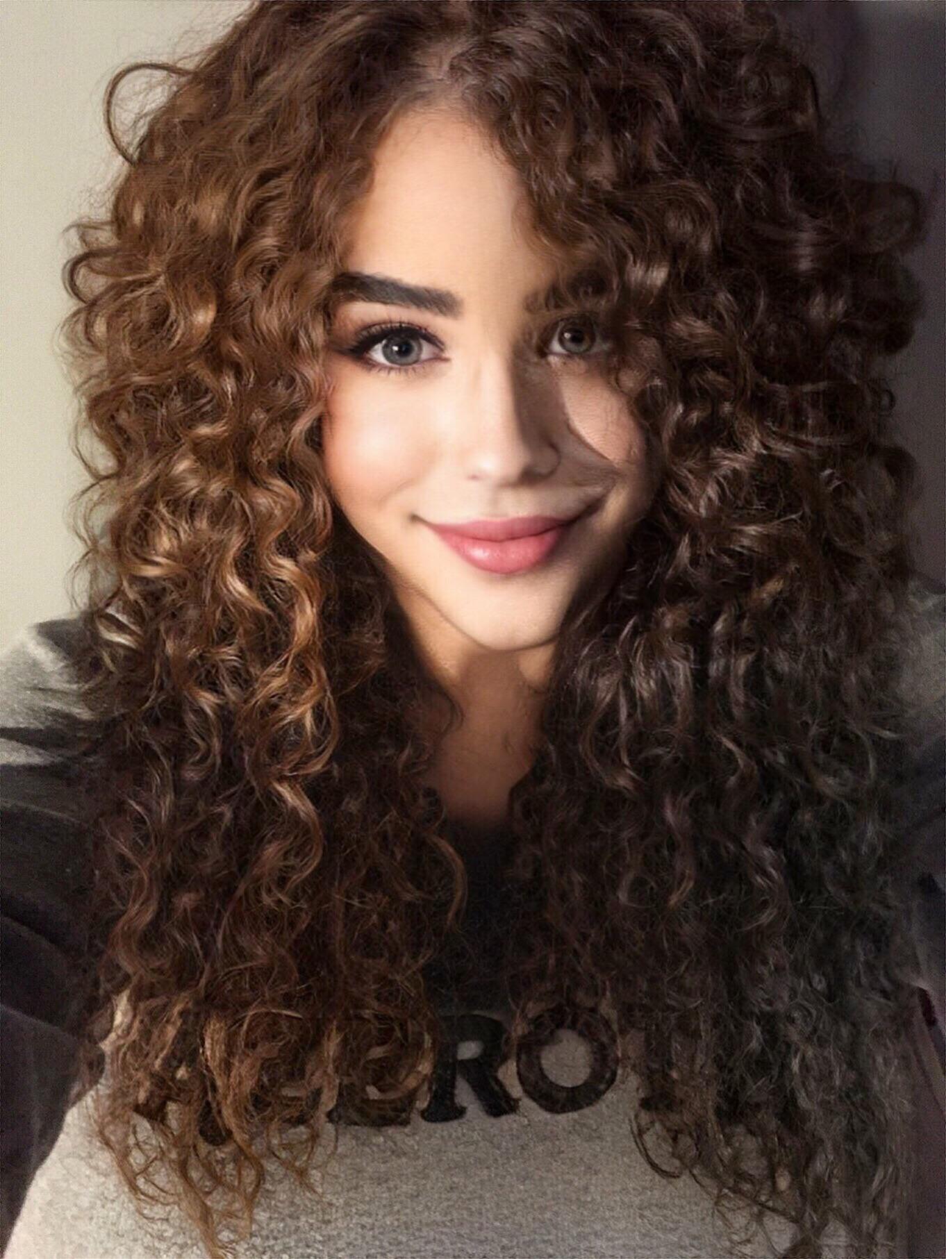 First time poster here! Just got my First lips injection done! | Scrolller