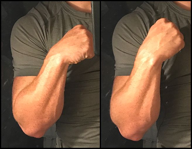 forearm belly | Scrolller