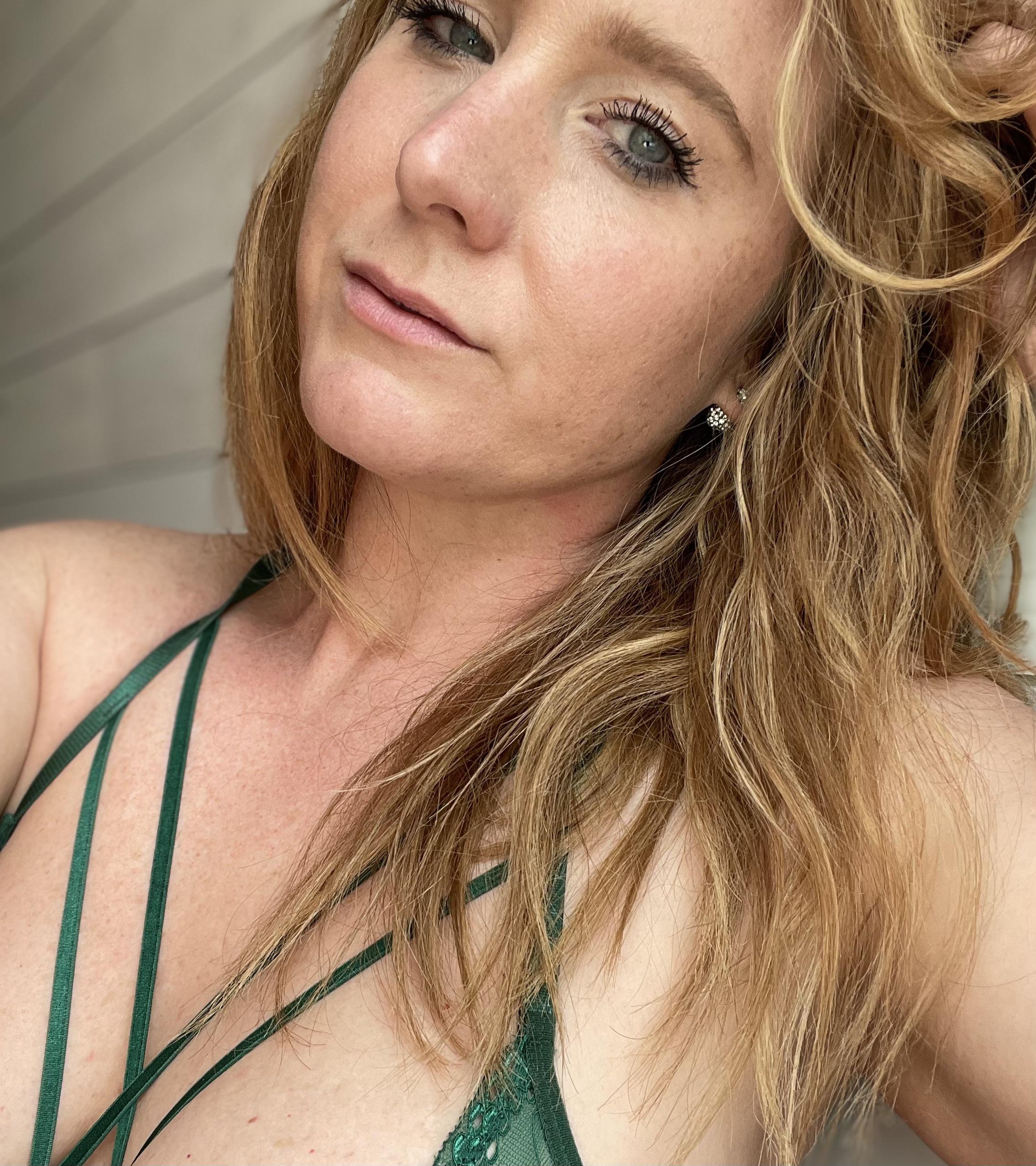 Freckle face | Scrolller