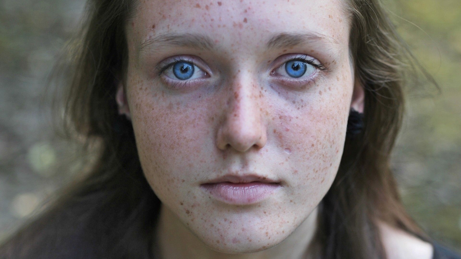 Freckled | Scrolller