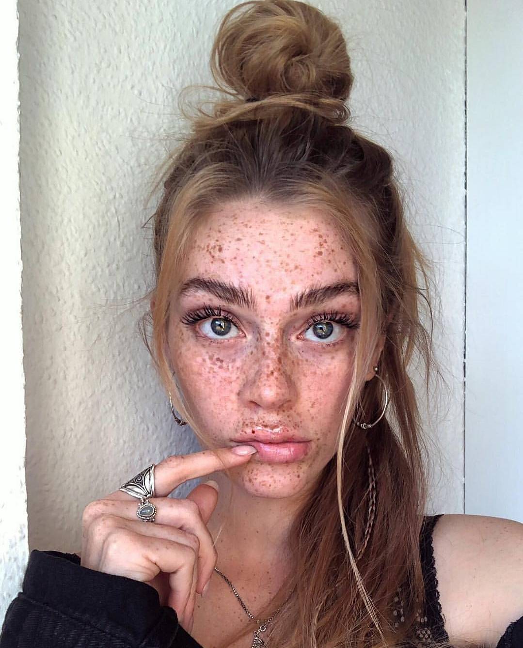 Freckles | Scrolller