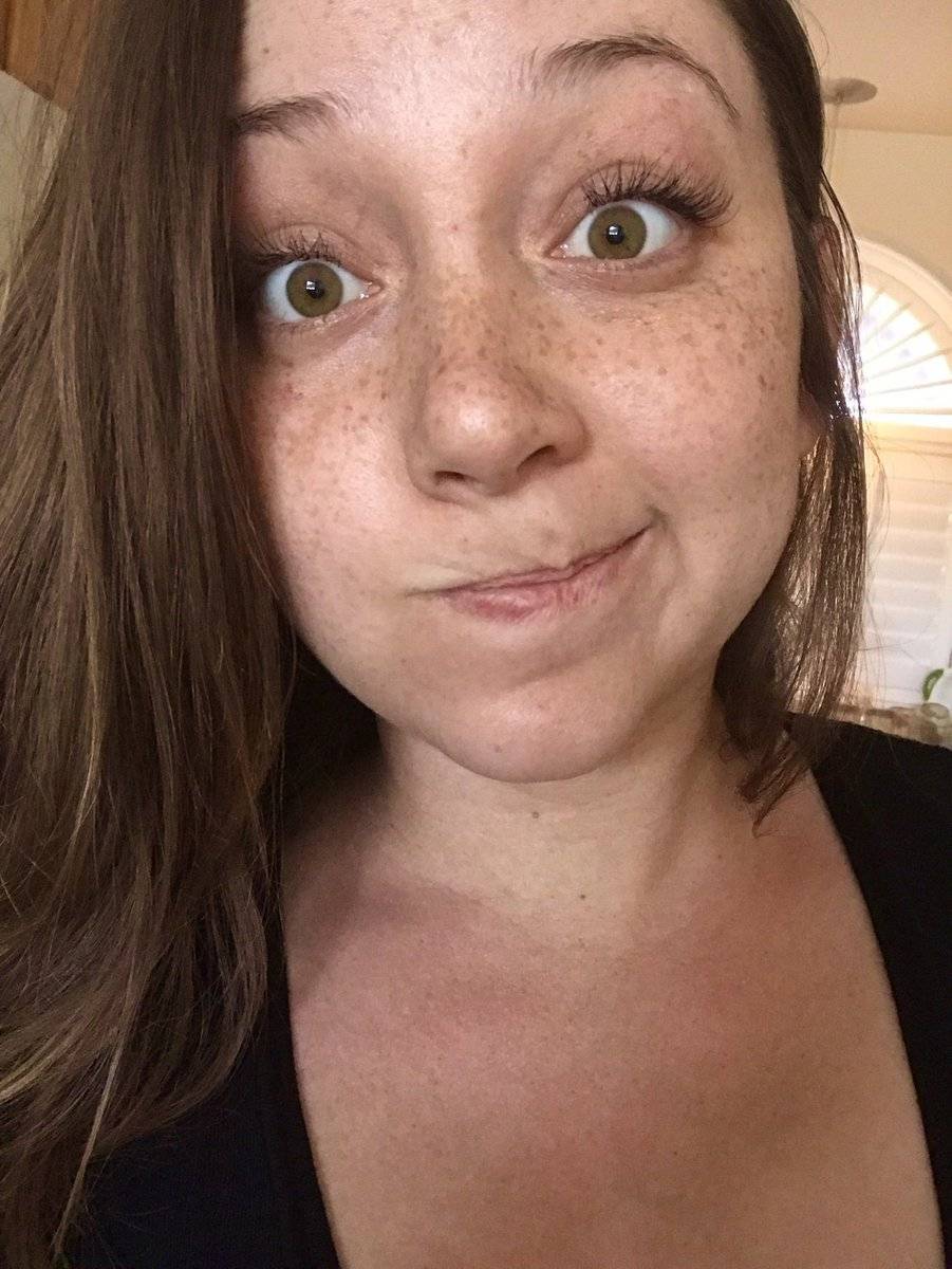 Freckles | Scrolller