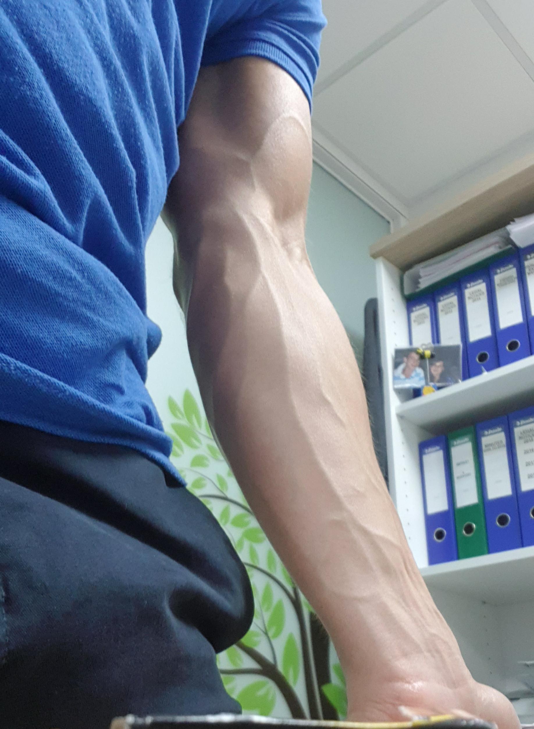 Good morning veins. | Scrolller