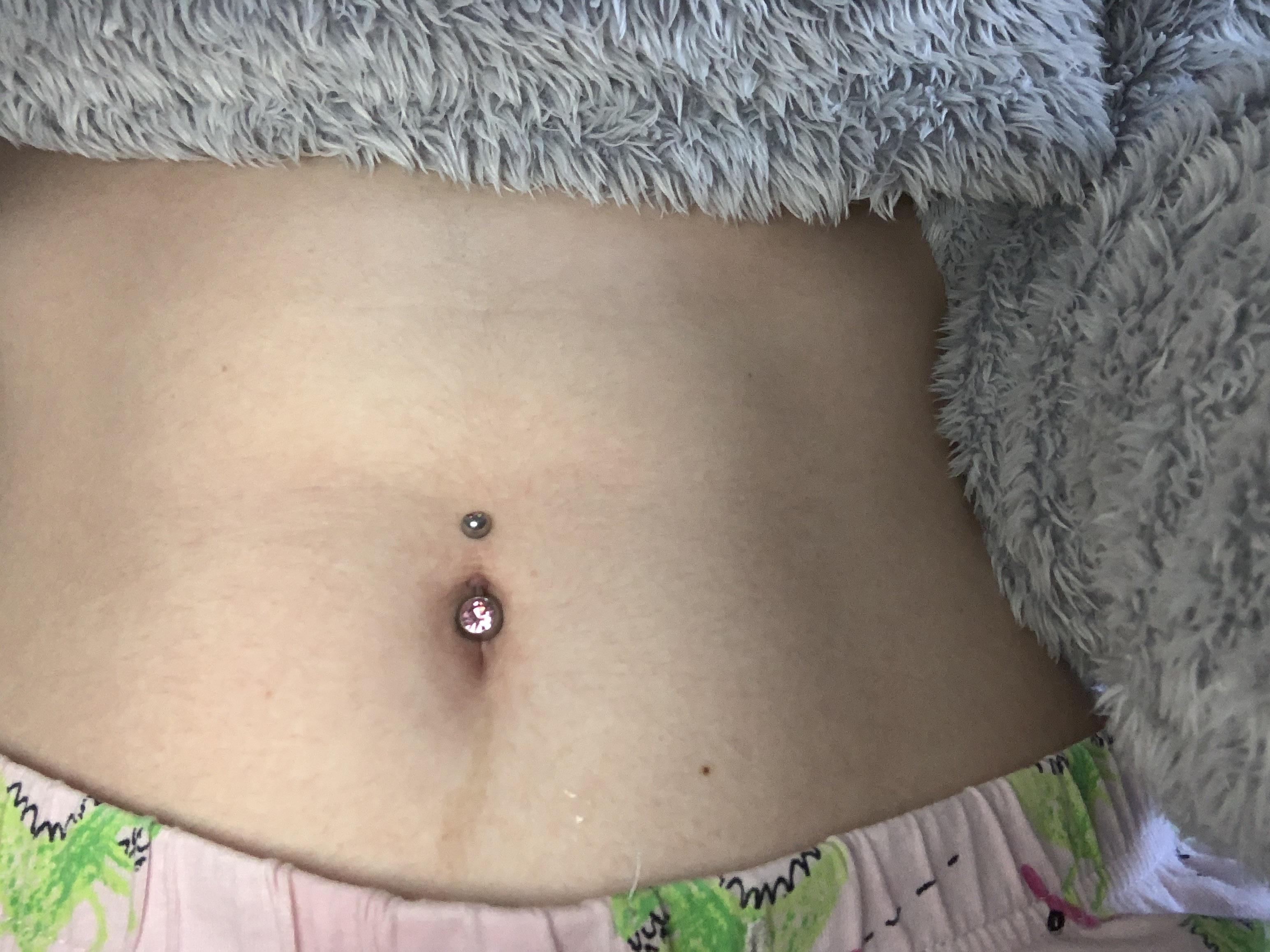 how to get rid of red bump around piercing? i’ve had this since 2017. is my piercing an okay ...
