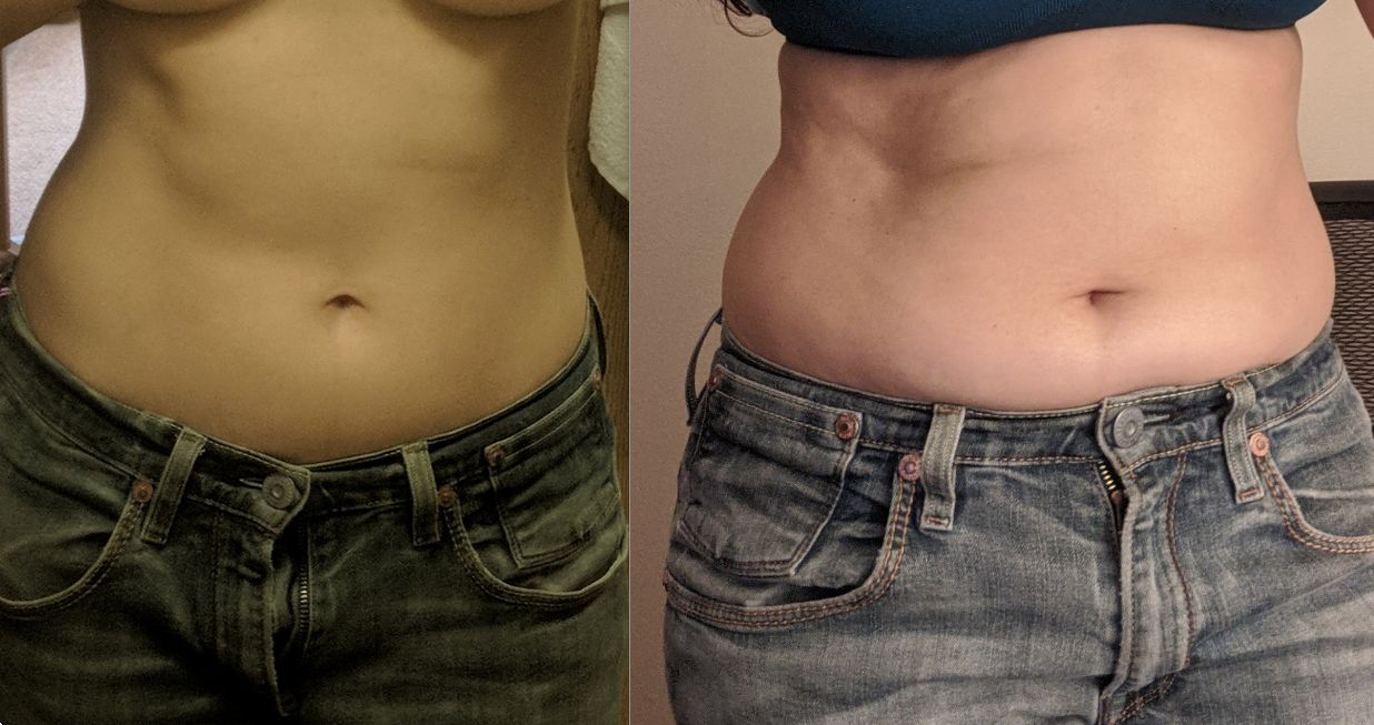 Is it noticeable? | Scrolller