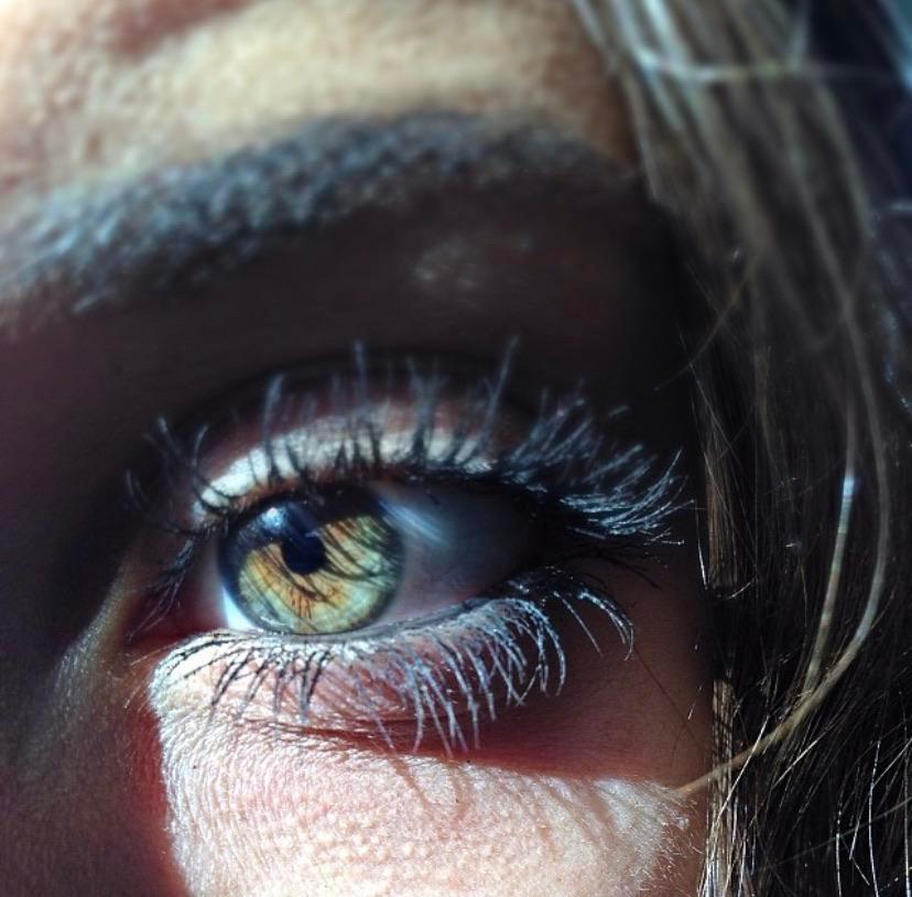 Is this heterochromia? Also is this hazel? When they’re not in sunlight they just look light ...