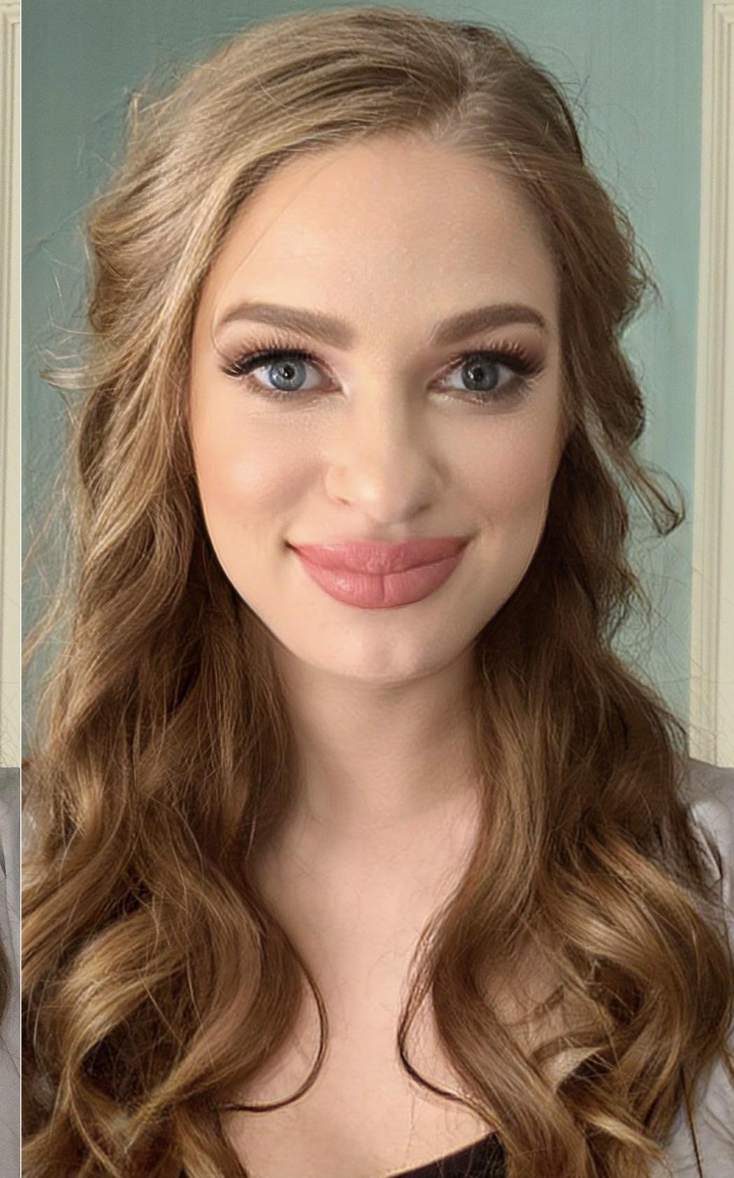 It’s awesome what botox and filler can do. | Scrolller