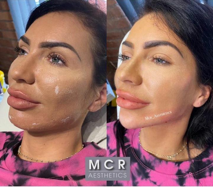 It's called the "Kim K Package" 😶 | Scrolller