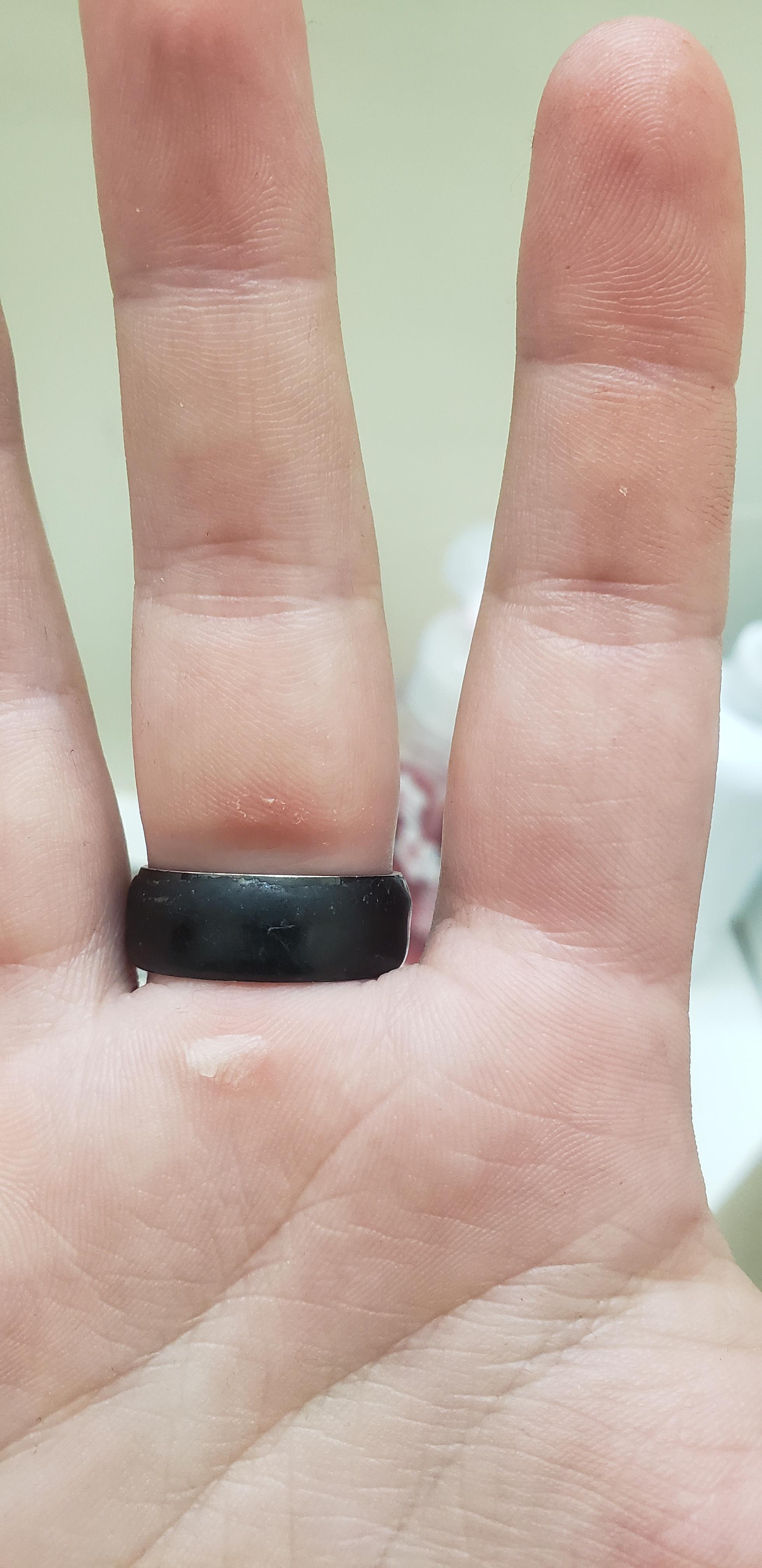 I've worn my Ace ring every day for over a year. My finger has shaped to it. | Scrolller