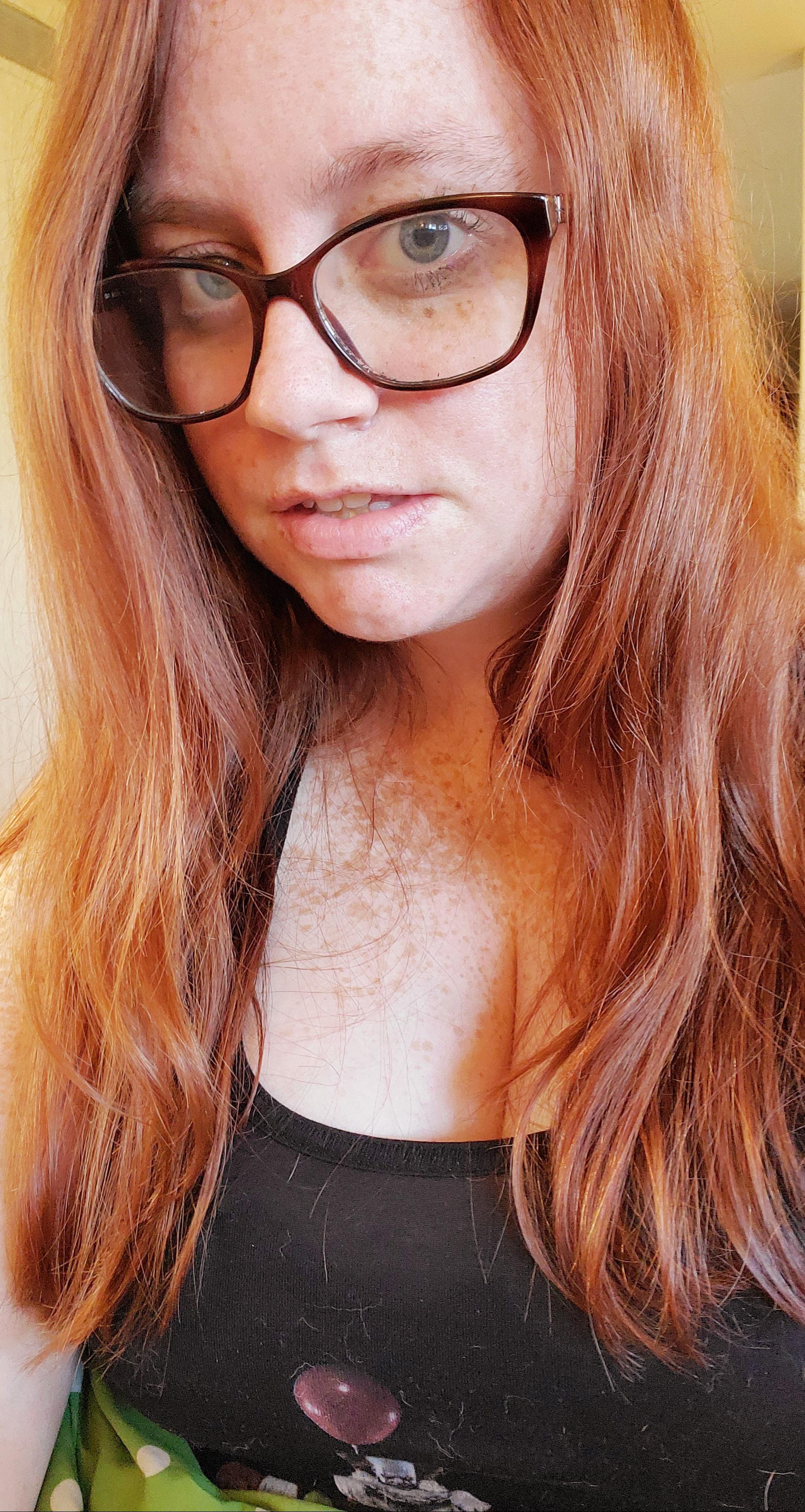 Just in case you wanted a freckle fix | Scrolller