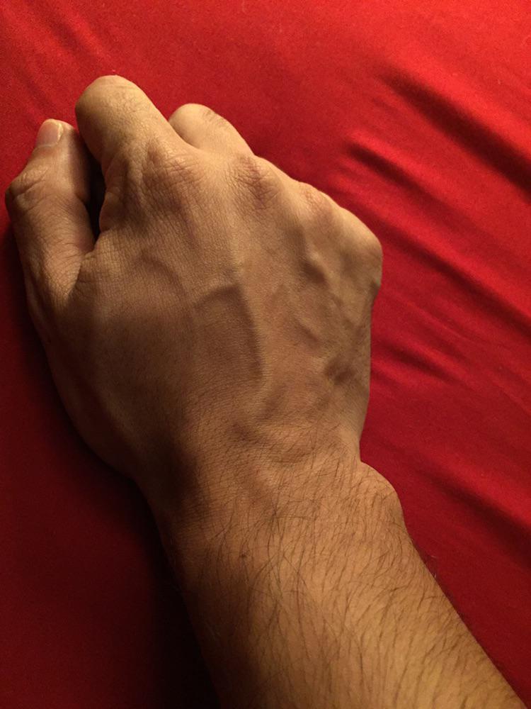 Like veiny hands ? | Scrolller