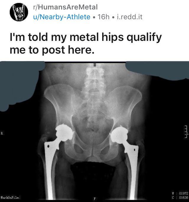 Literally metal... | Scrolller