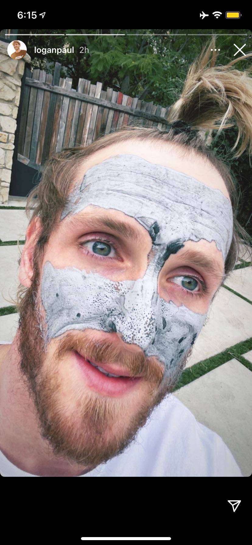 Logan Paul’s hairline | Scrolller