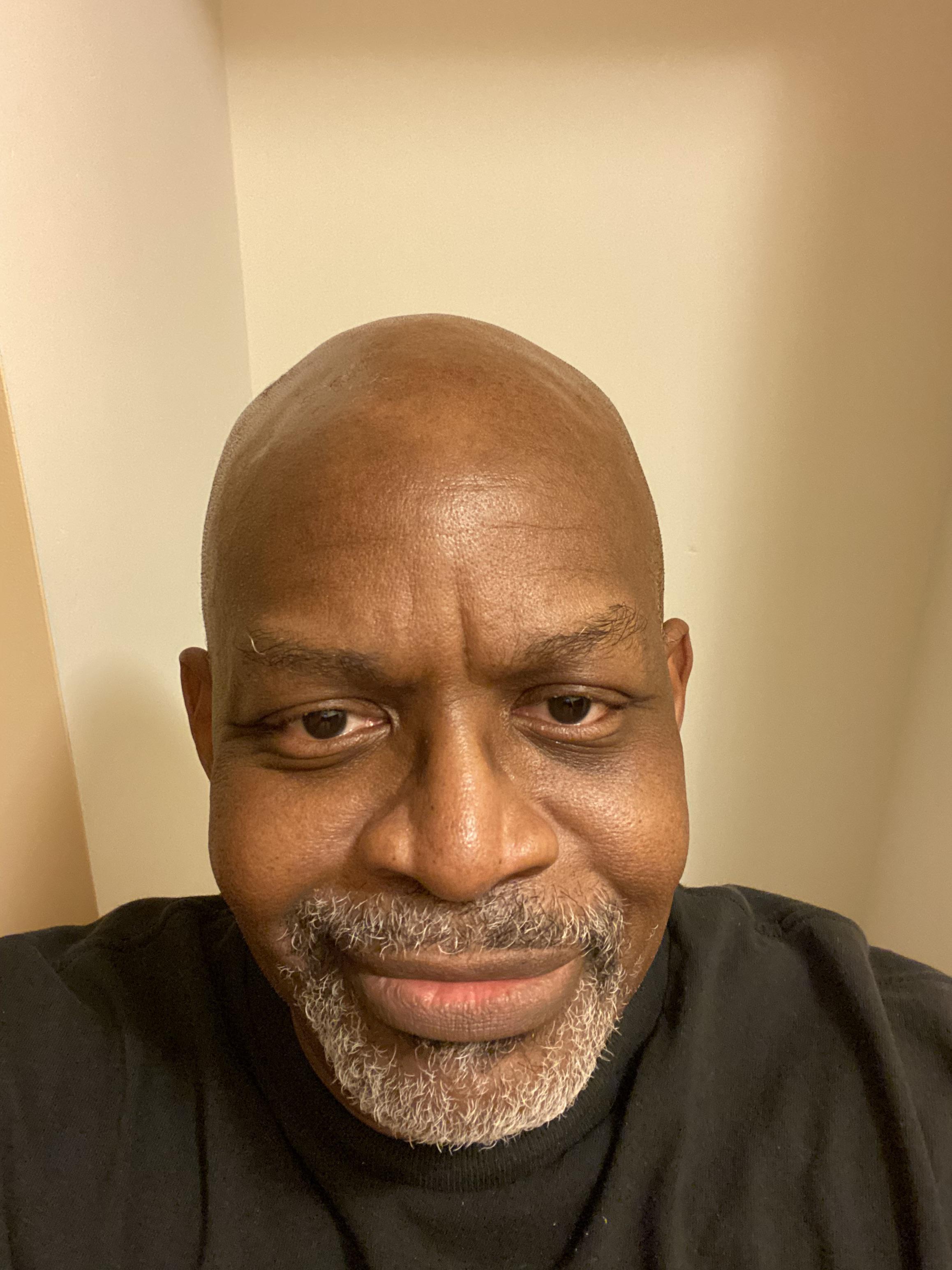 [M]58 Freshly shaved head! #BLM | Scrolller