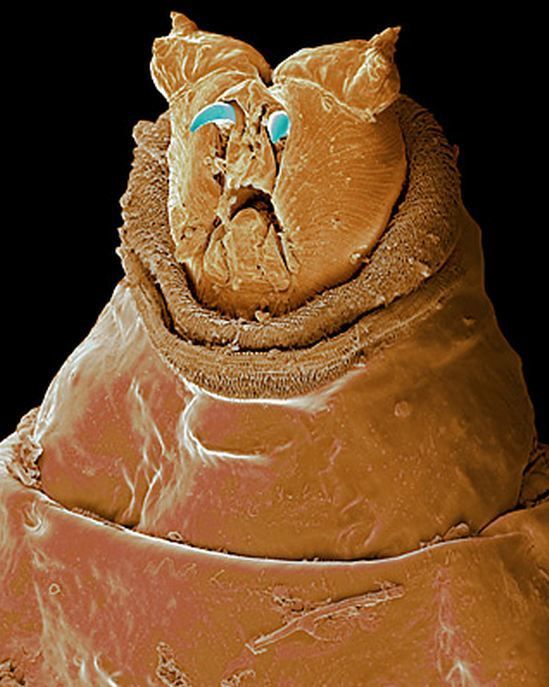 Maggot under electron microscope 🔬 🐛 | Scrolller