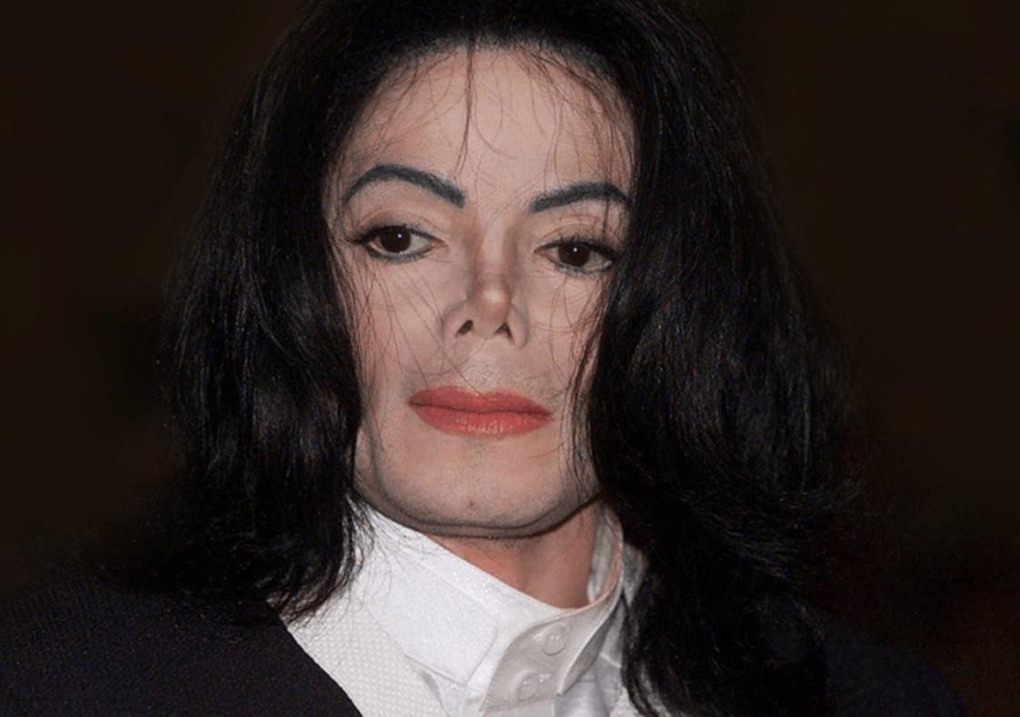 Michael Jackson after his operations | Scrolller