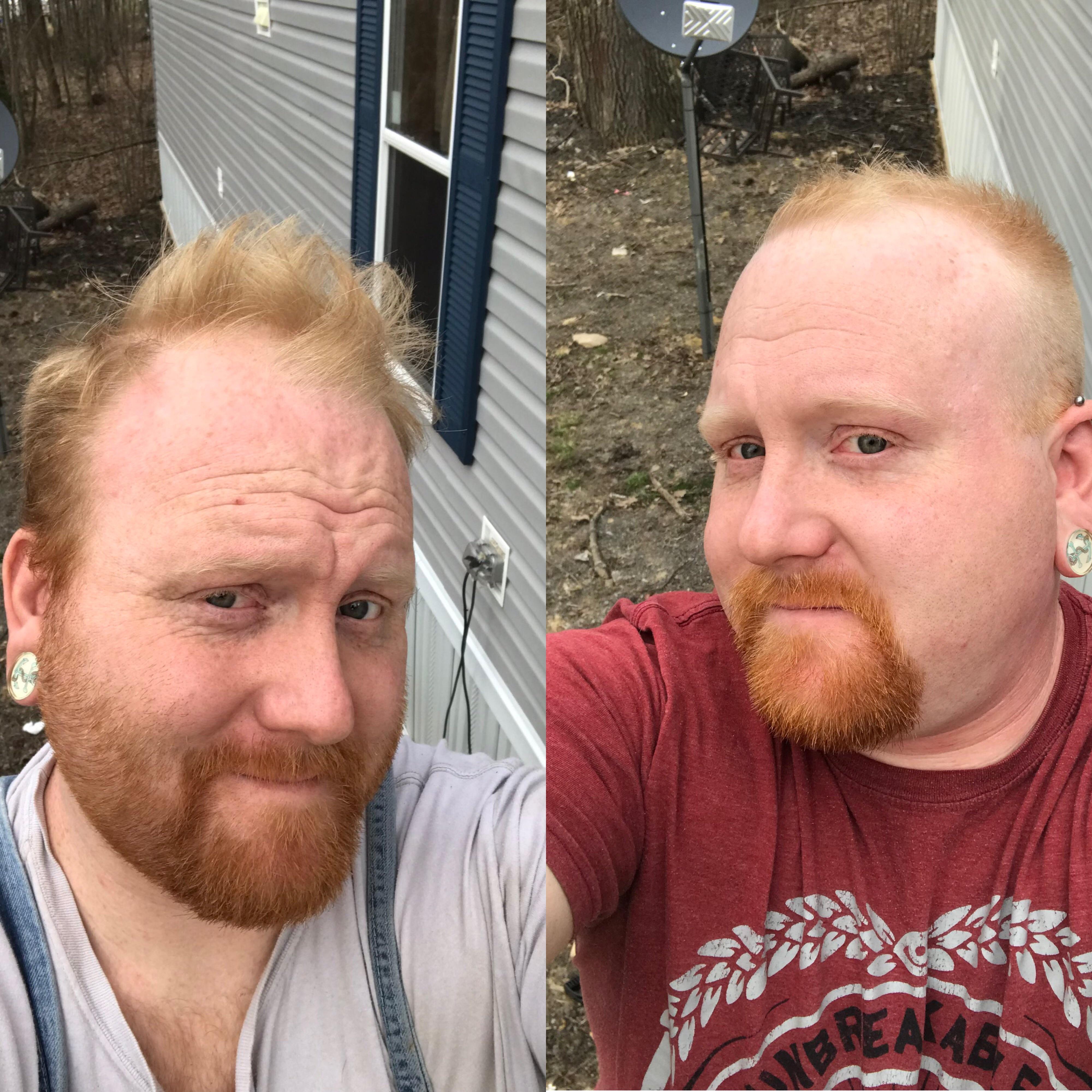 Mountain Ginger vs Clean cut Ginger | Scrolller