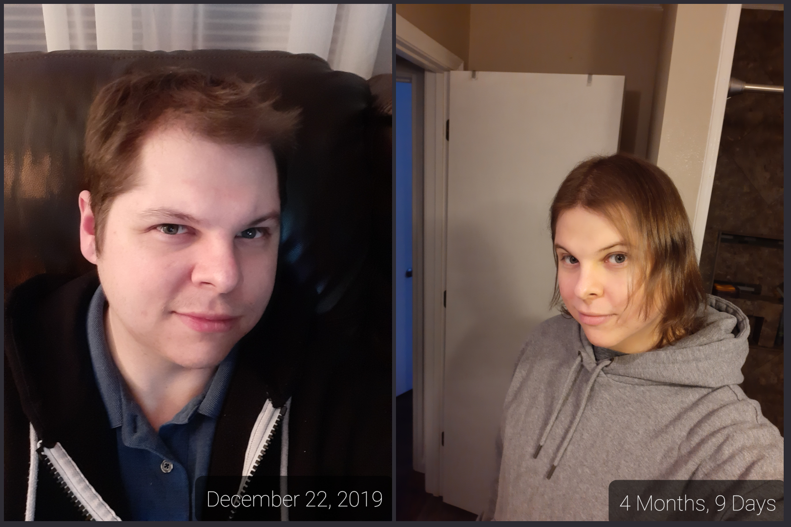 MTF -9 months to +4 months HRT 32-33 | Scrolller
