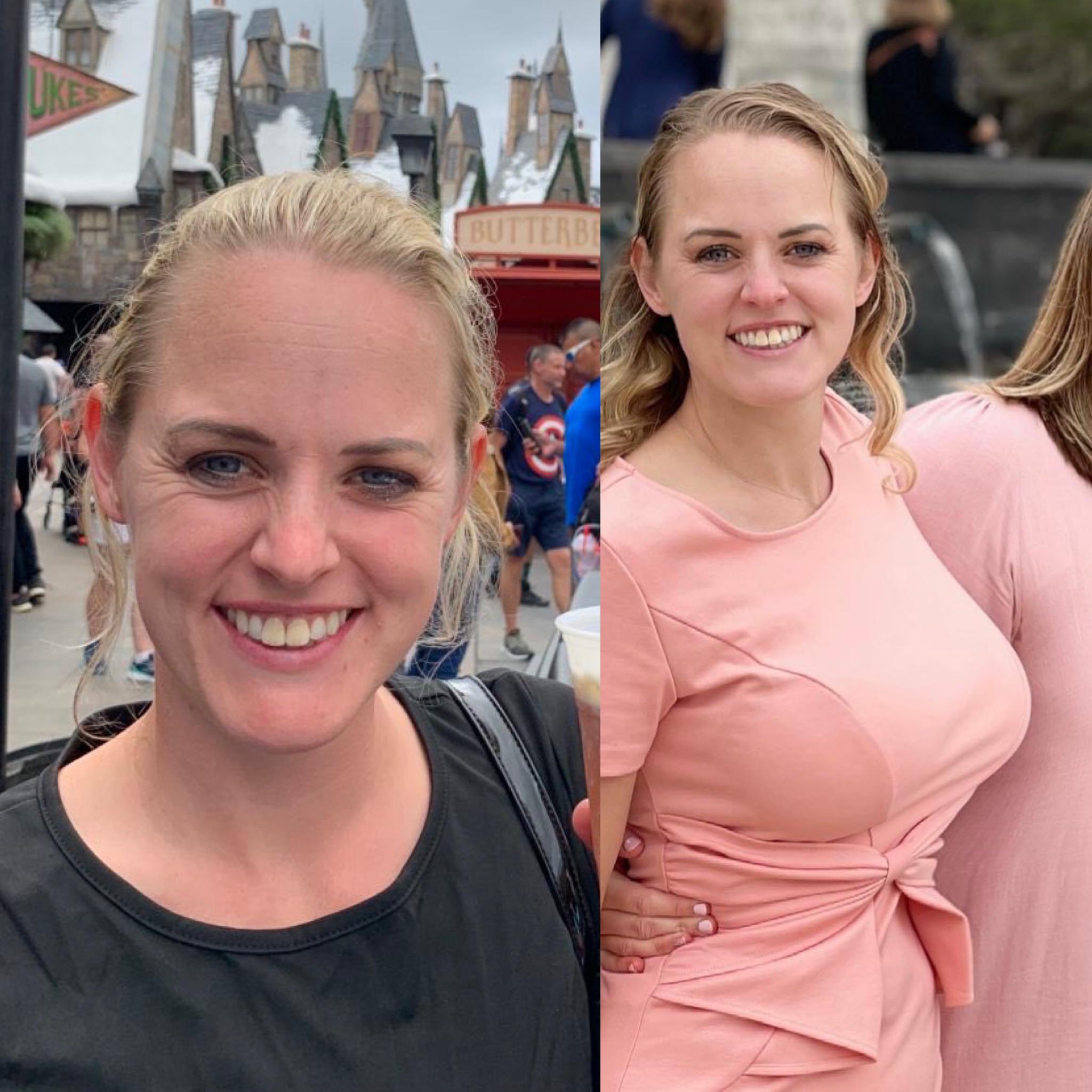 32 year old mom of 3. | Scrolller