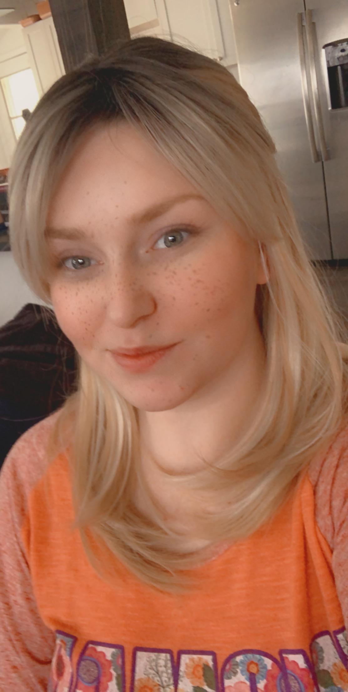 My first wig! I have alopecia areata so this might be a new normal for me! | Scrolller