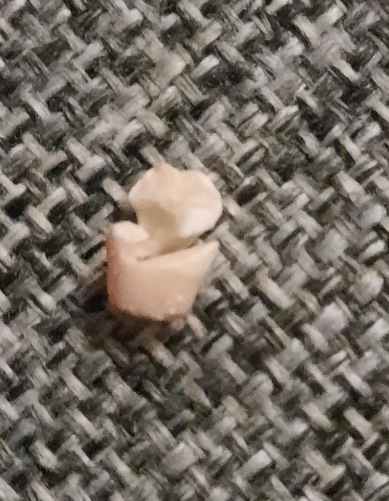 My tooth | Scrolller