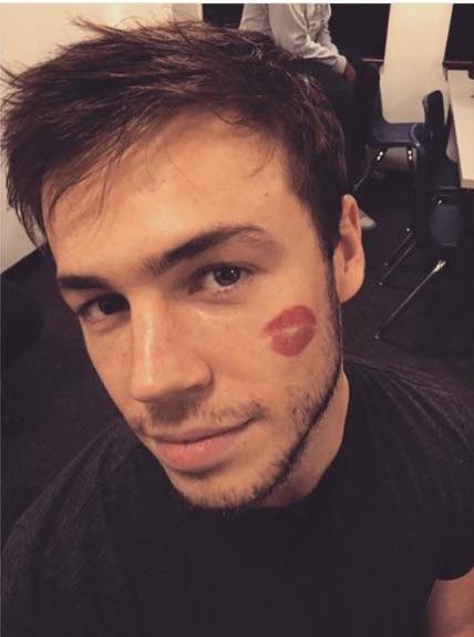 Nice cheek kiss mark | Scrolller