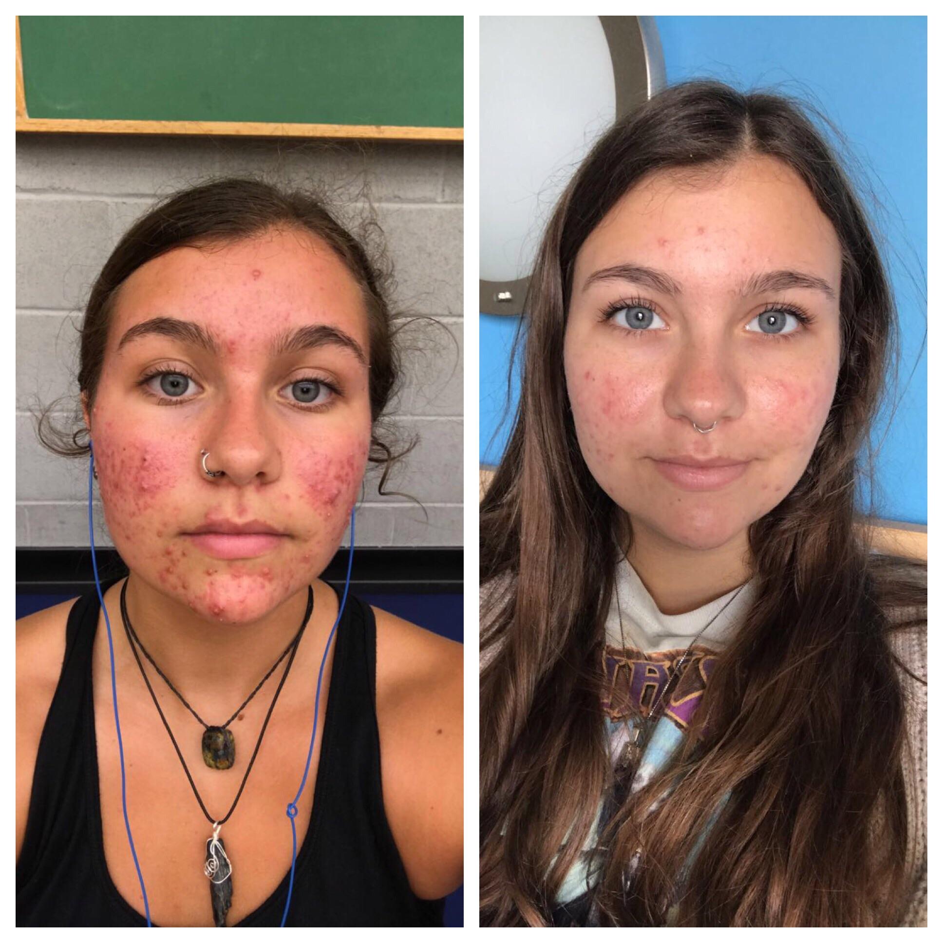 One year progress!!! | Scrolller