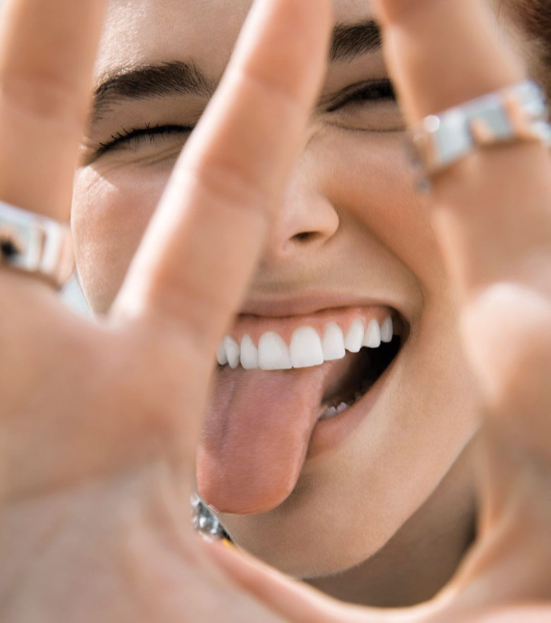 Perfect teeth | Scrolller