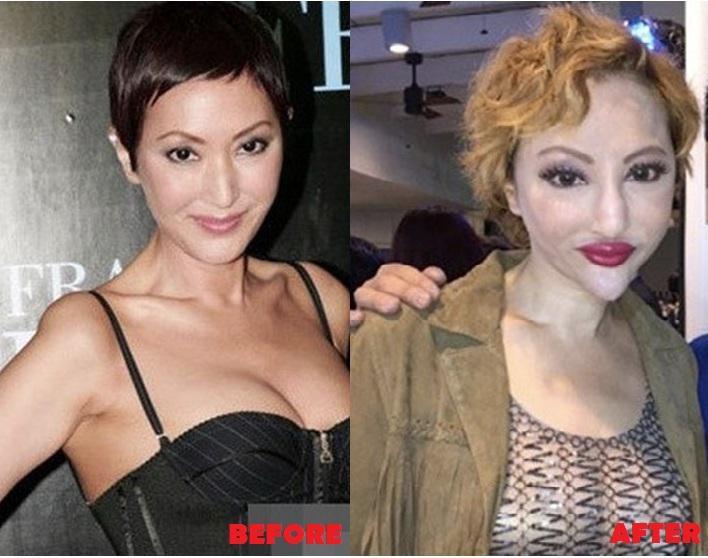 Pointy chin | Scrolller