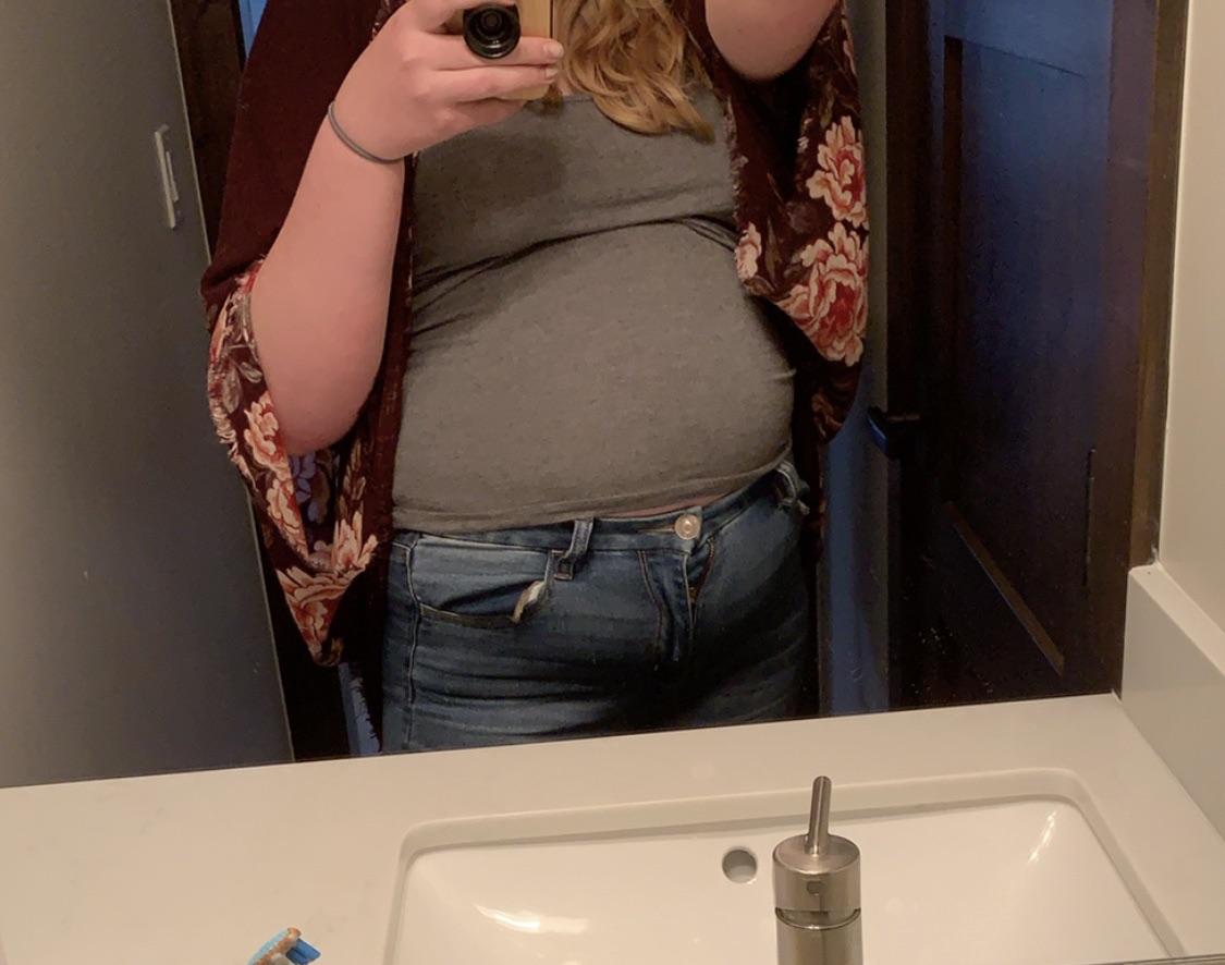 Popped the button last night 🙊🐷 | Scrolller