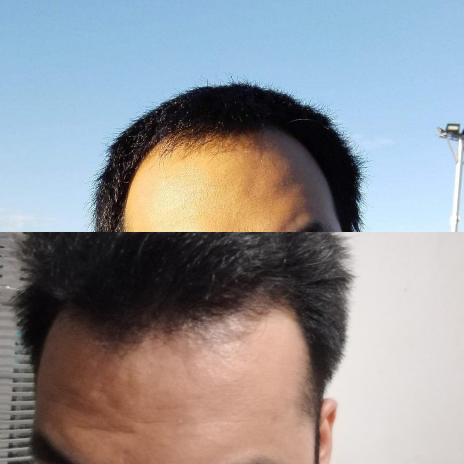 Progress Check. | Scrolller