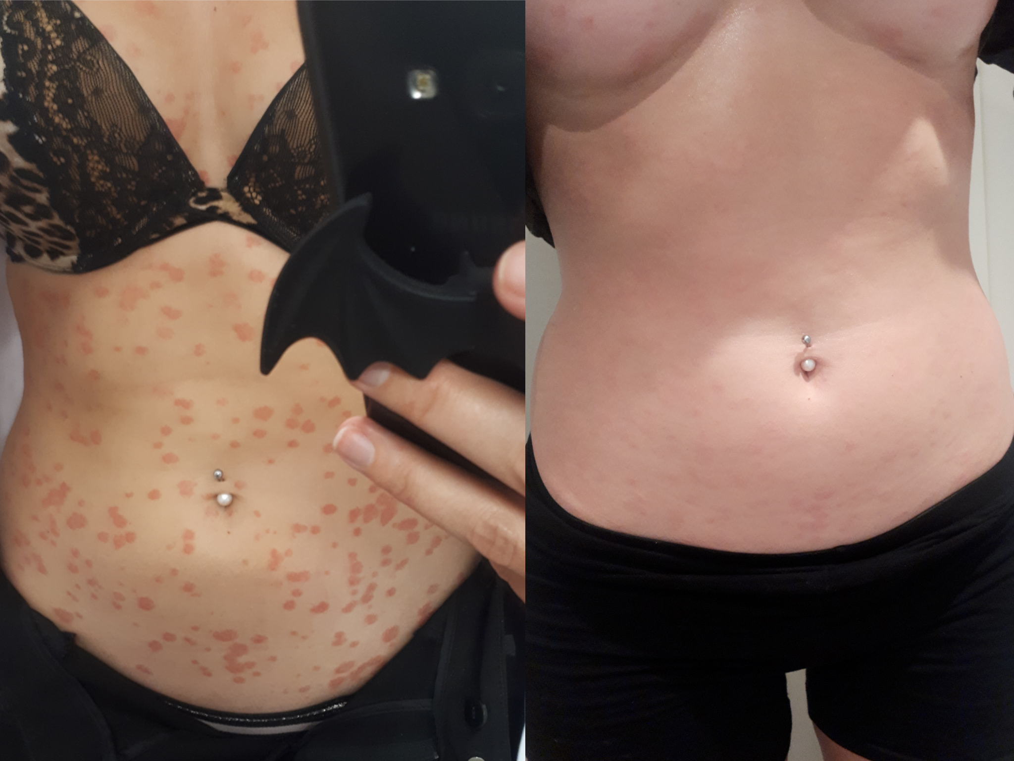 Progress finally! | Scrolller