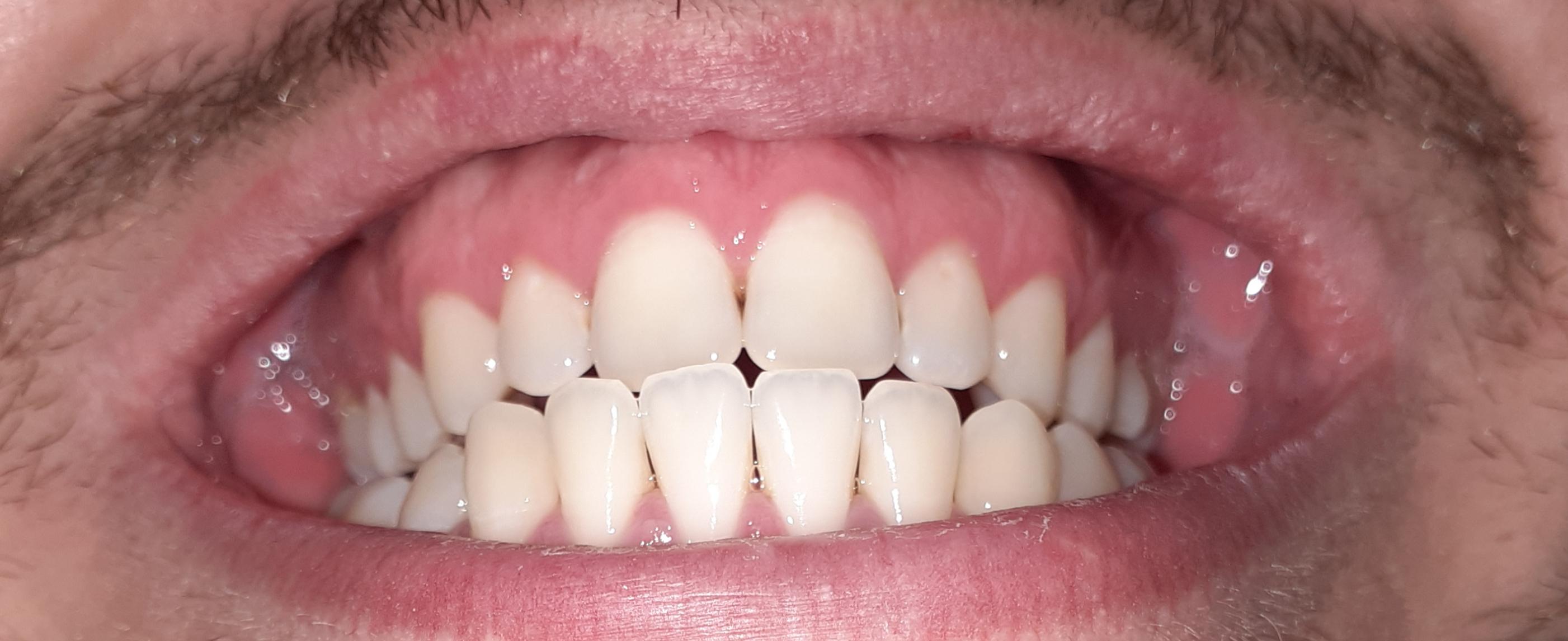 rate my teeth guys | Scrolller