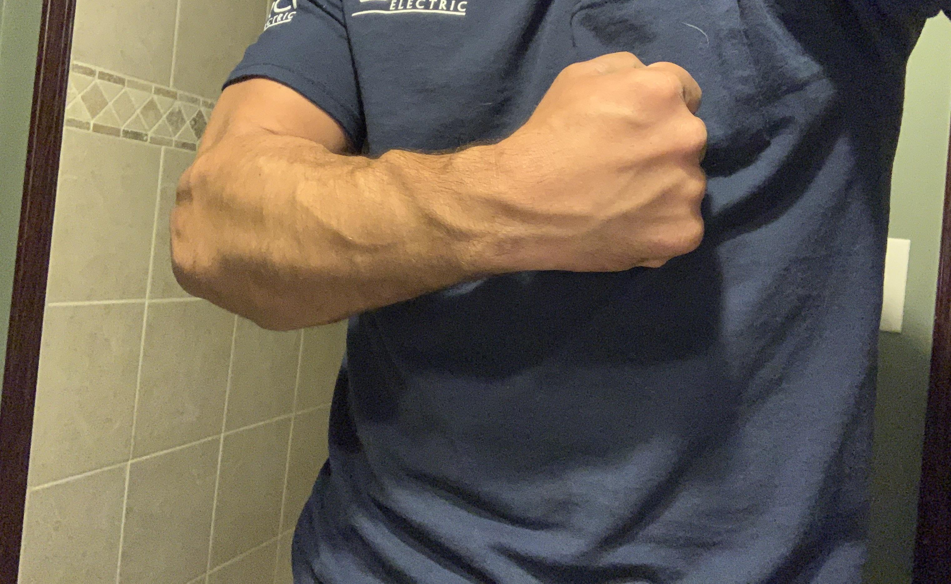 Right arm | Scrolller