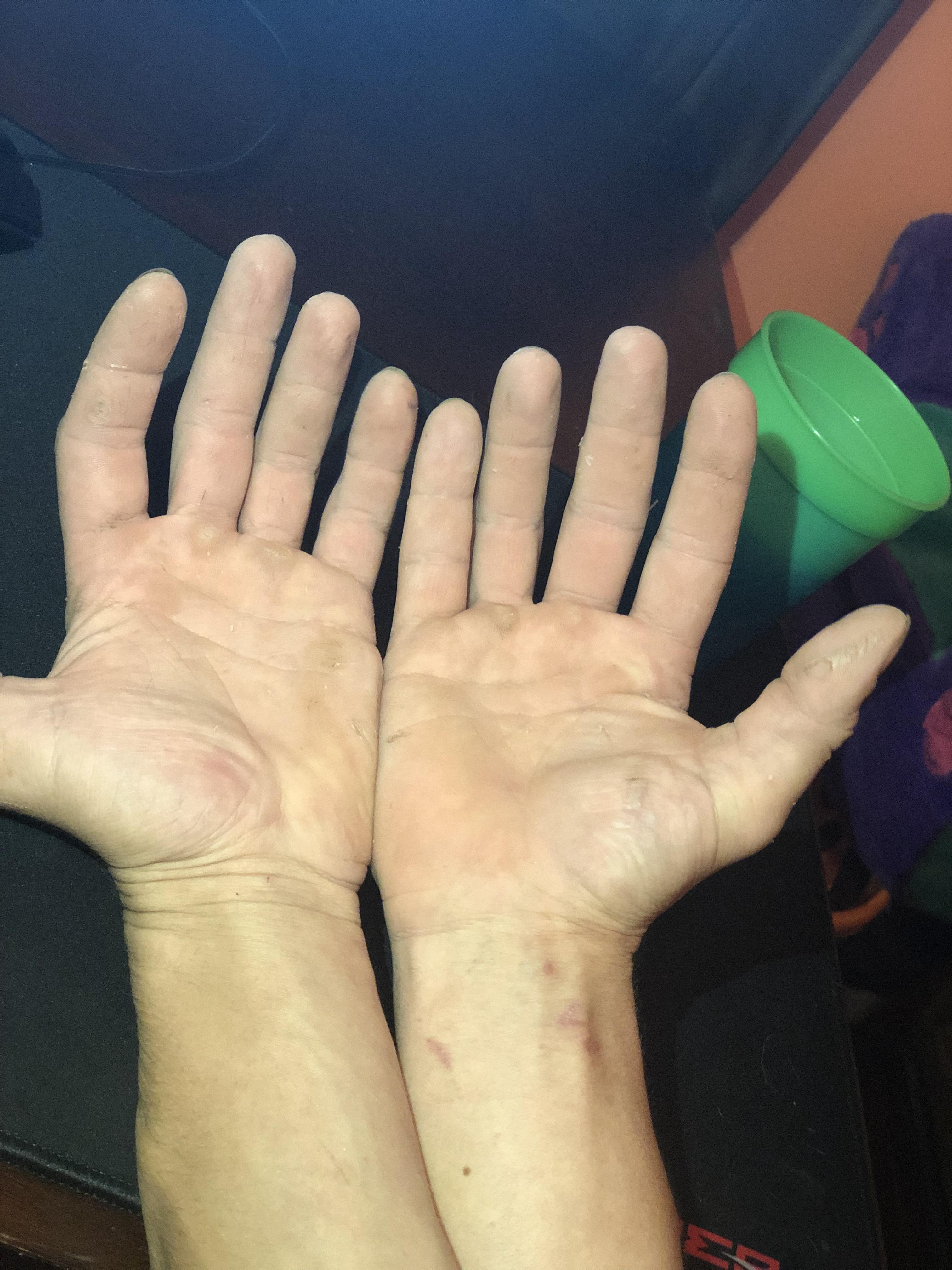 Rough hands | Scrolller