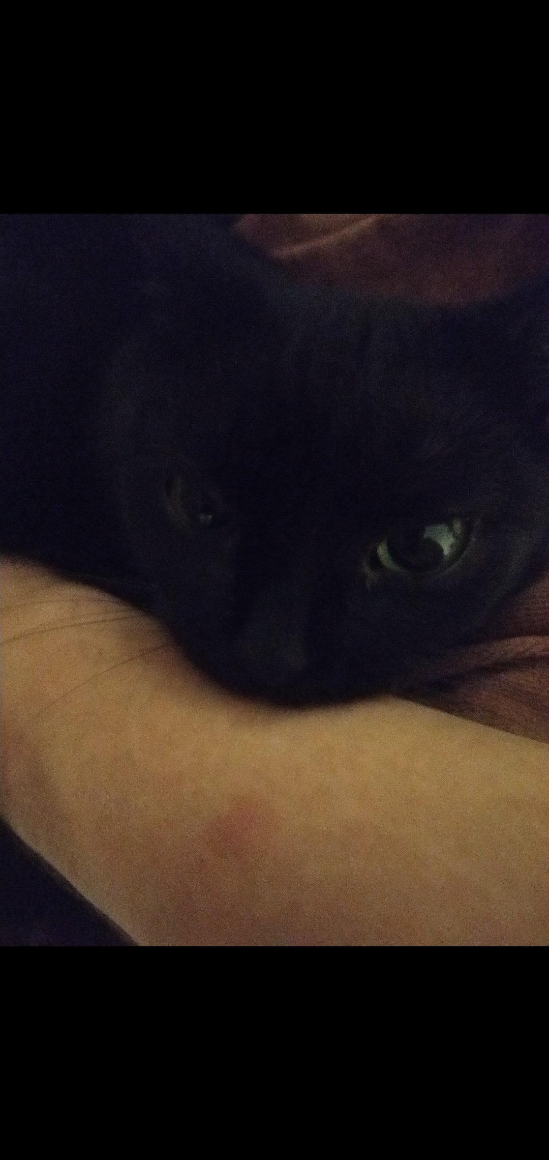 She bite me | Scrolller