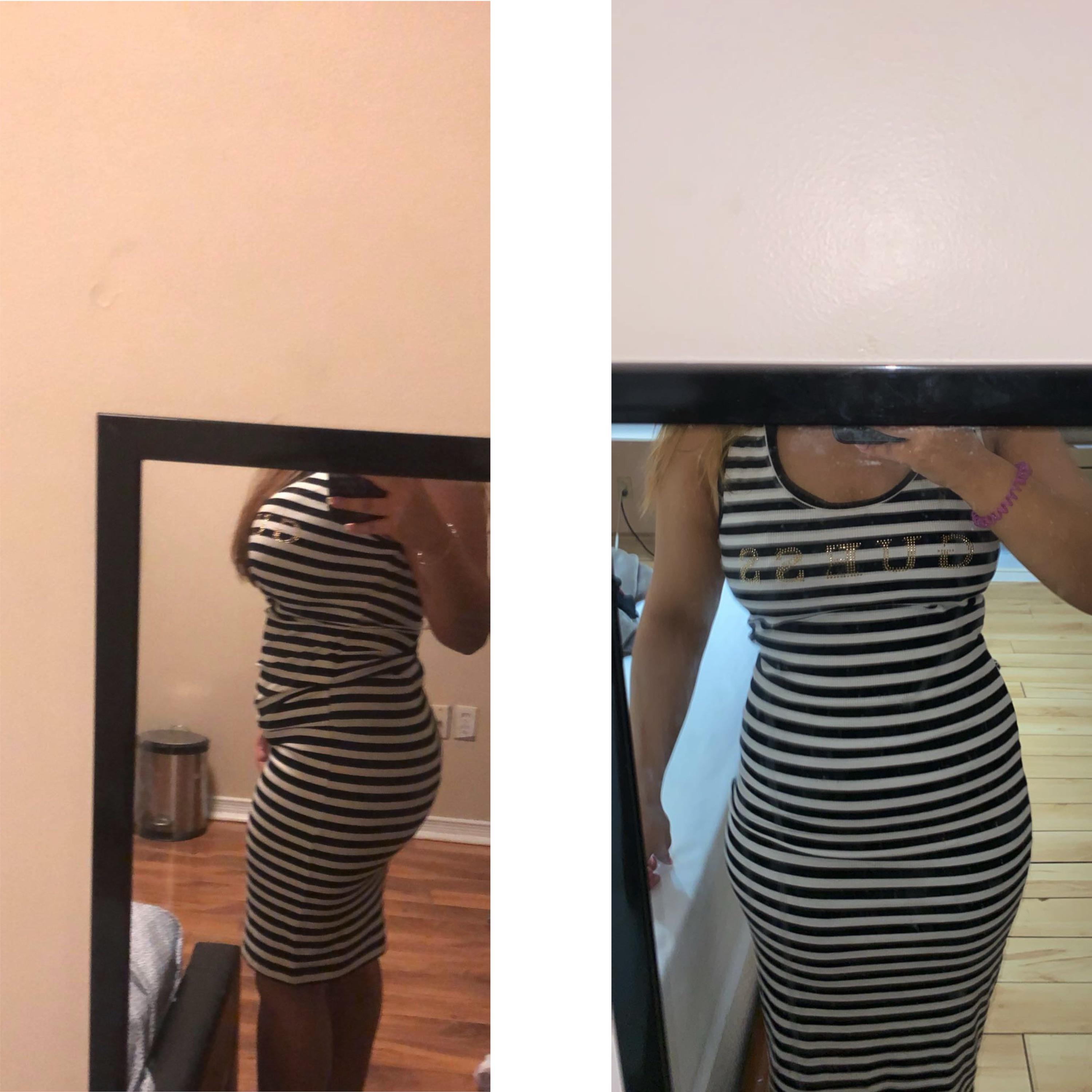 Six weeks po! Best decision I’ve ever made | Scrolller