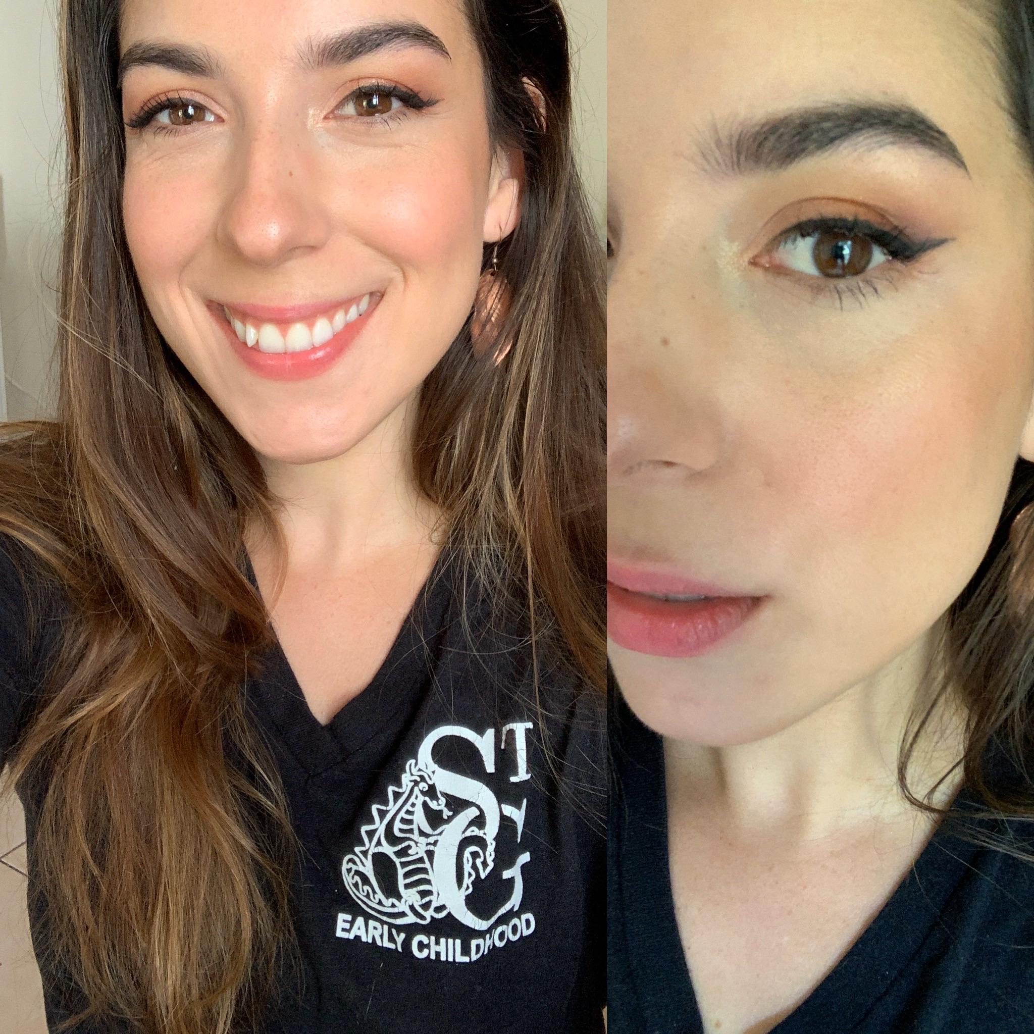 Soft and warm wing on my droopy outer lids | Scrolller