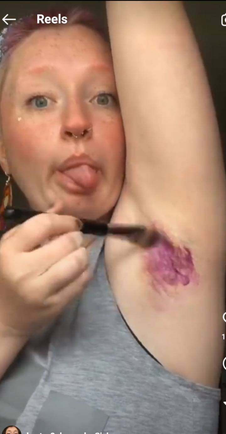 That's gotta itch | Scrolller