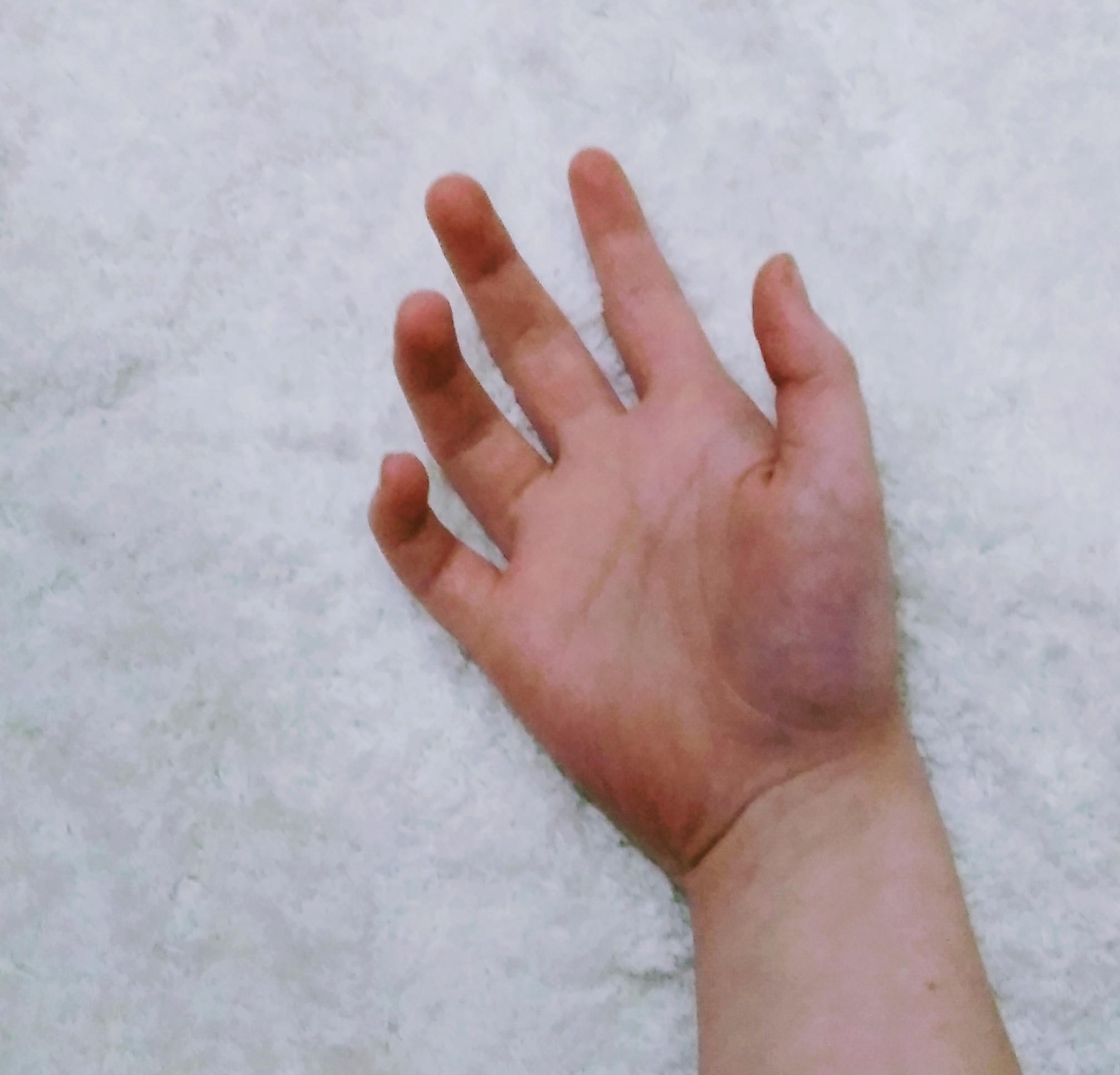 they're so small😳 it can be hard to pick big things up 😣 | Scrolller