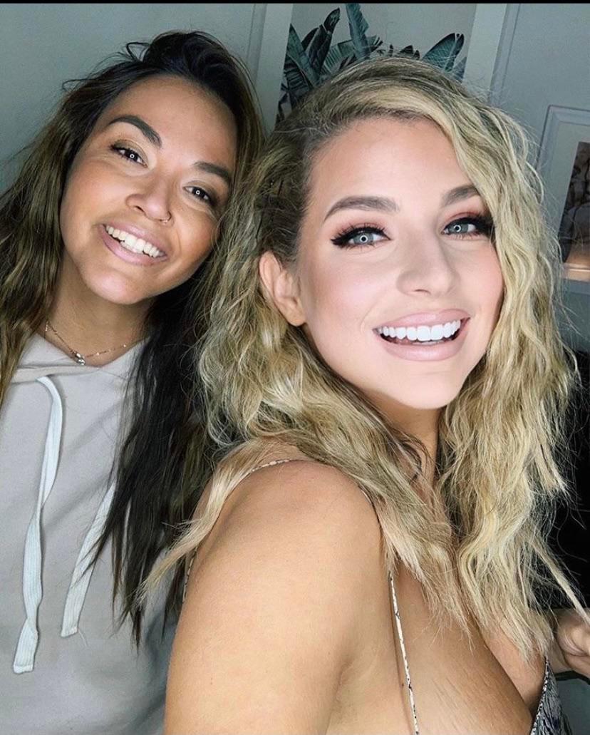 Those stretch marks | Scrolller