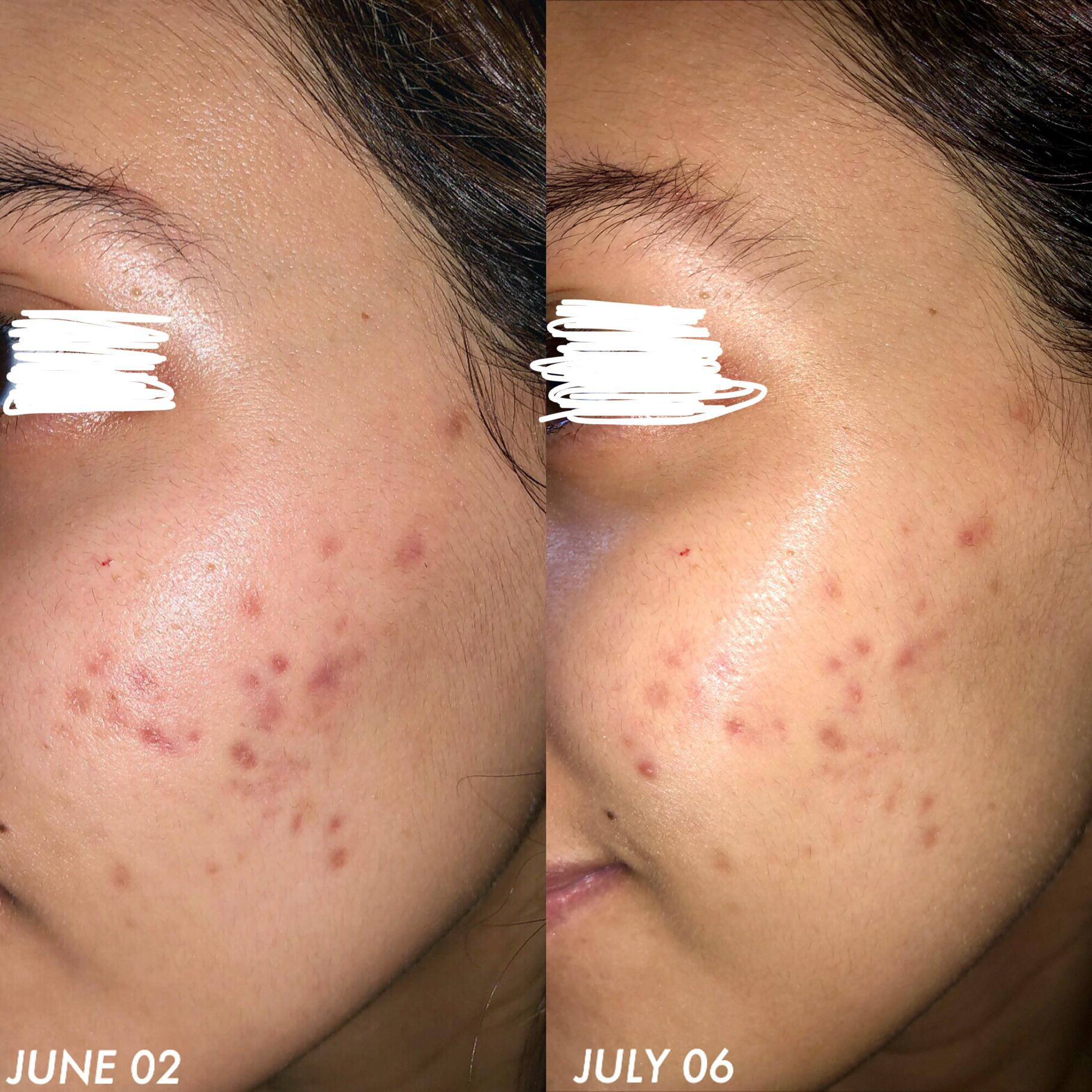 Trusting the process! | Scrolller