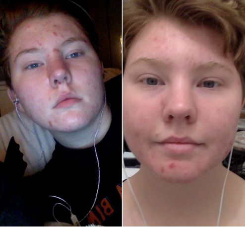 two months difference!!!! | Scrolller