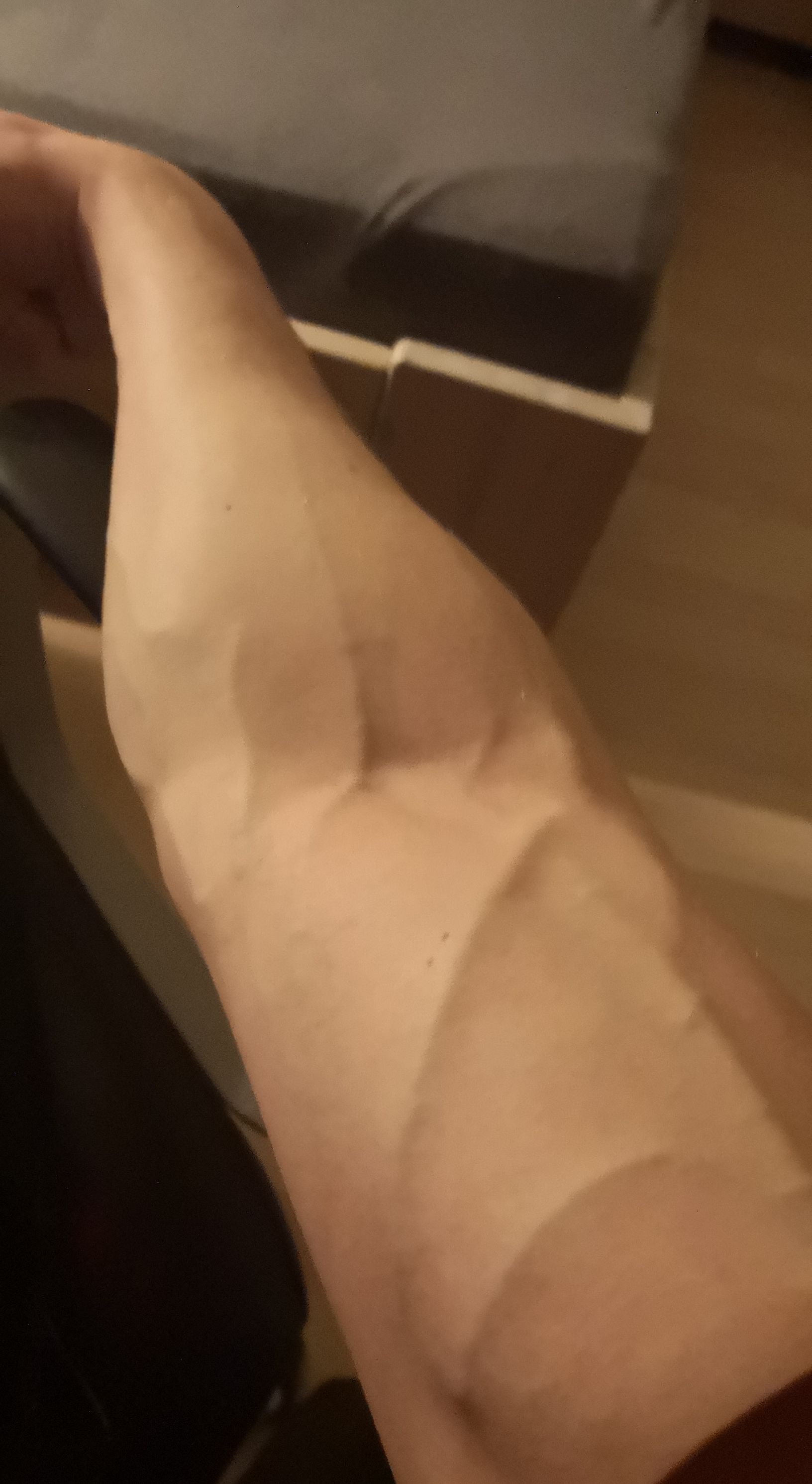 Vein check | Scrolller