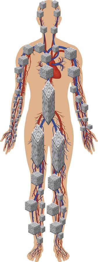 We made the veins full of titanium | Scrolller
