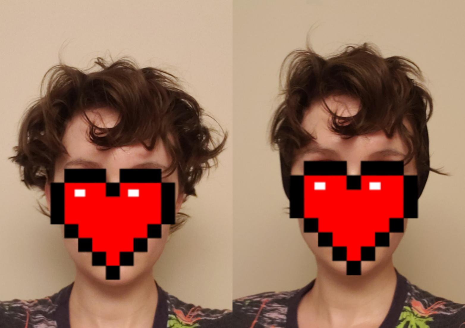 welcome to the awkward phase, hope you like headbands! | Scrolller